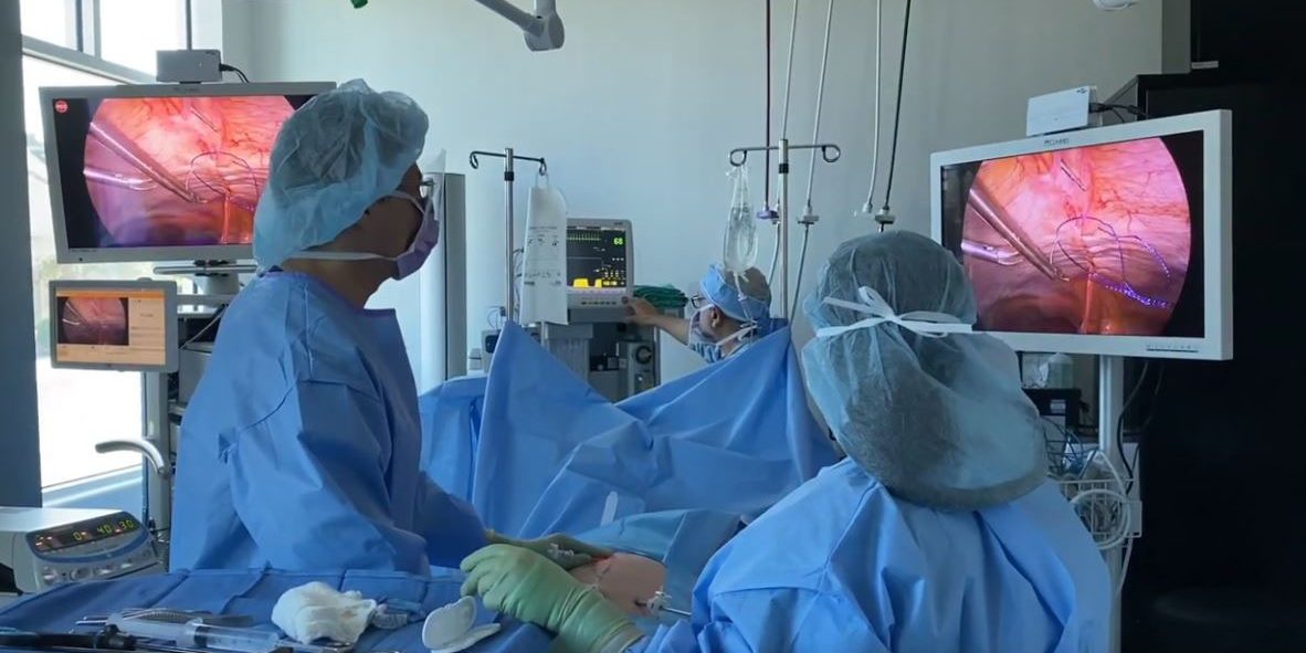 New technique for repairing Diastasis Recti by Dr. Iraniha